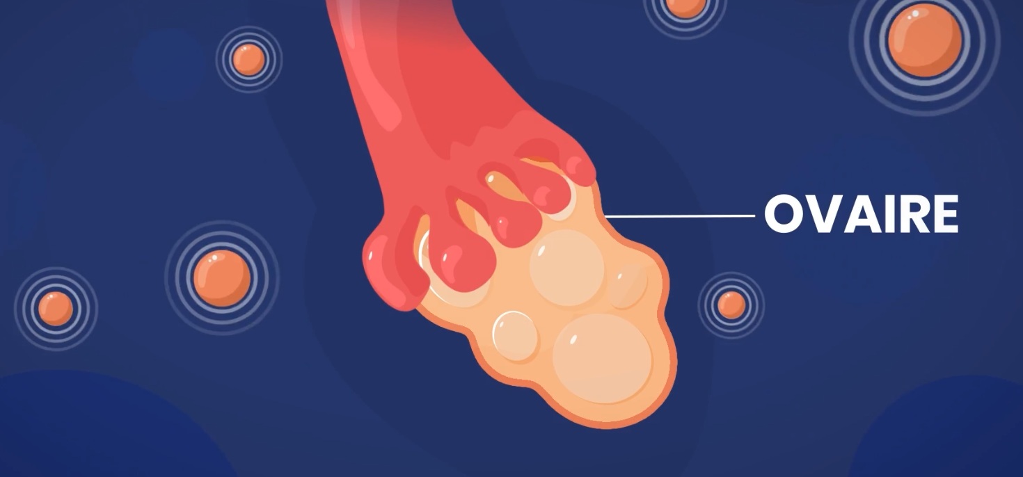 Understanding oocyte vitrification, step by step! | CHU clermont-ferrand